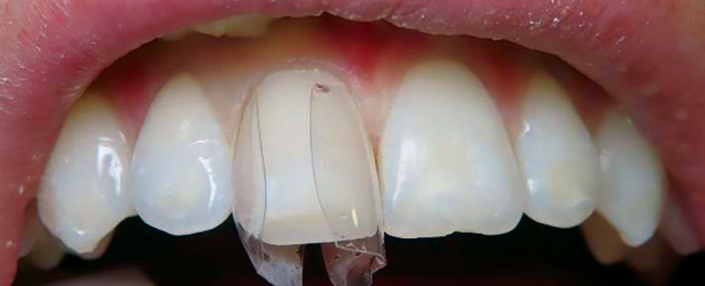 Yanda Dental Care - Klinik Gigi Berkualitas dengan Fasilitas Modern